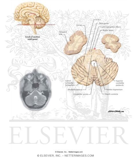 Horizontal Sections Through the Forebrain: Mid Pons