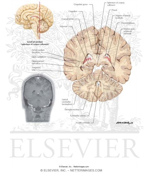 Coronal Sections Through the Forebrain: Splenium of Corpus Callosum