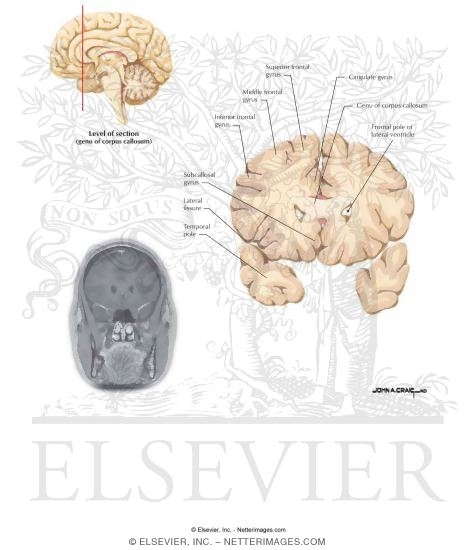 Coronal Sections Through the Forebrain: Genu of Corpus Callosum