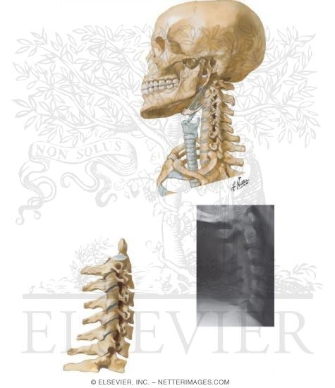 Bony Framework of Head and Neck