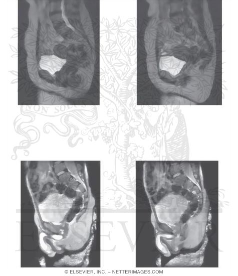 Pelvic Scans: Sagittal MR Images