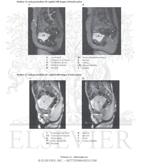 Pelvic Scans: Sagittal MR Images