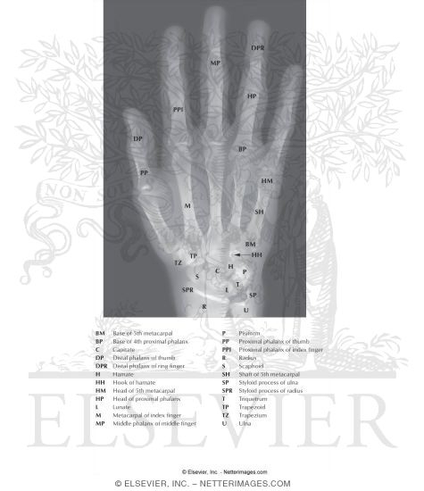Wrist and Hand: Anteroposterior Radiograph