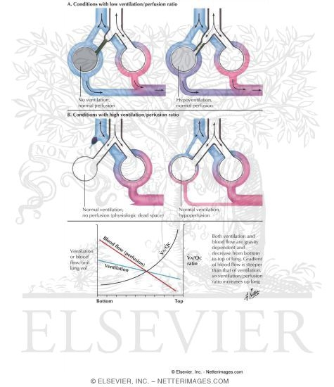 Ventilation-Perfusion (VA/Qc) Relationships