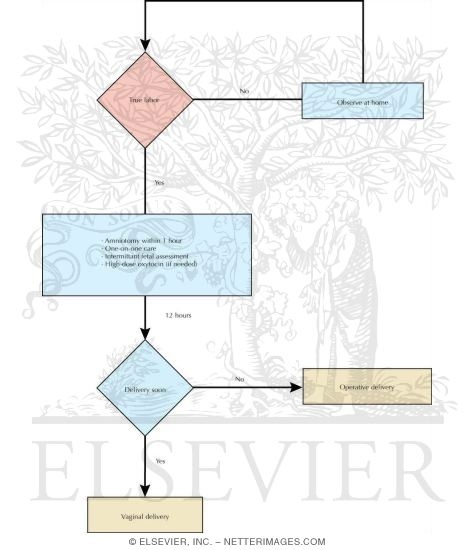 Active Management of Labor