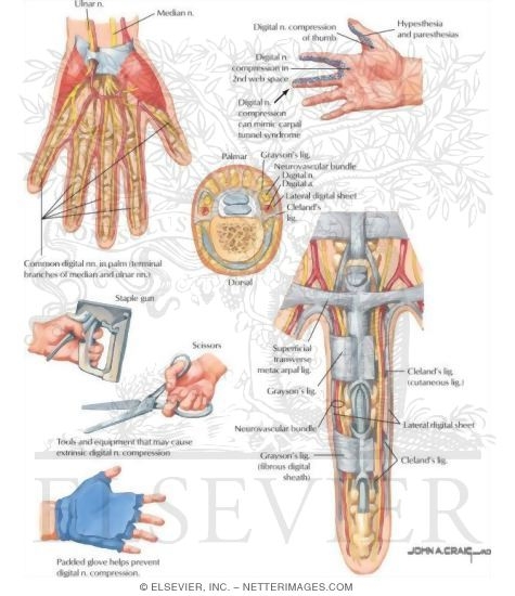 Digital Nerve Compression
