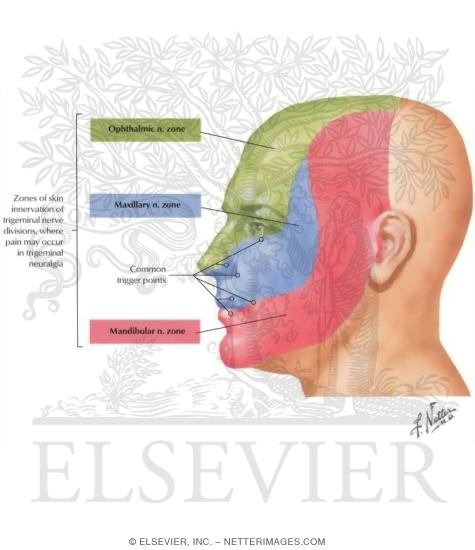 trigeminal impression nedir
