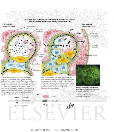 glomerular basement membrane ab