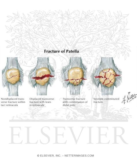 Welcome To Netter Images