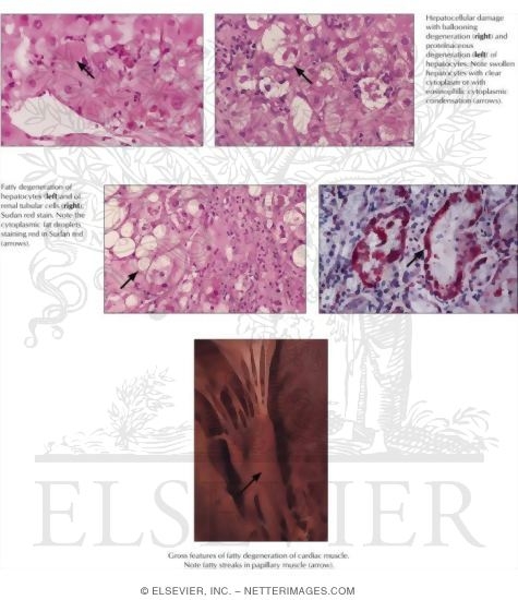 General Reaction Patterns: Degeneration