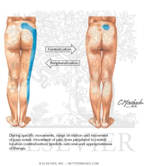 centralization phenomenon