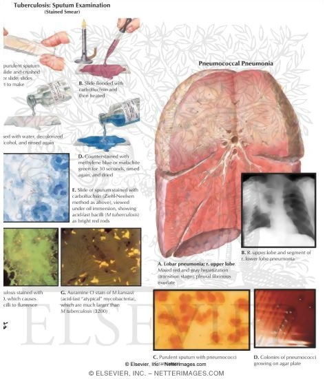 Examples of Resistance
