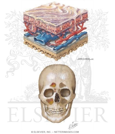 Overview and Topographic Anatomy of the Paranasal Sinuses
