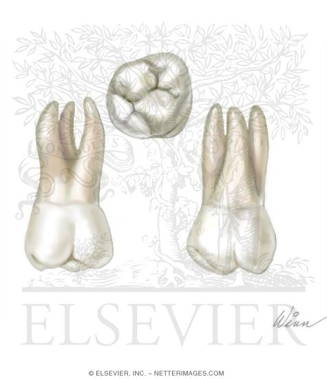 Maxillary 1st Molar (Right Side)