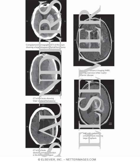 Neurodiagnostic Tests Used for Evaluation