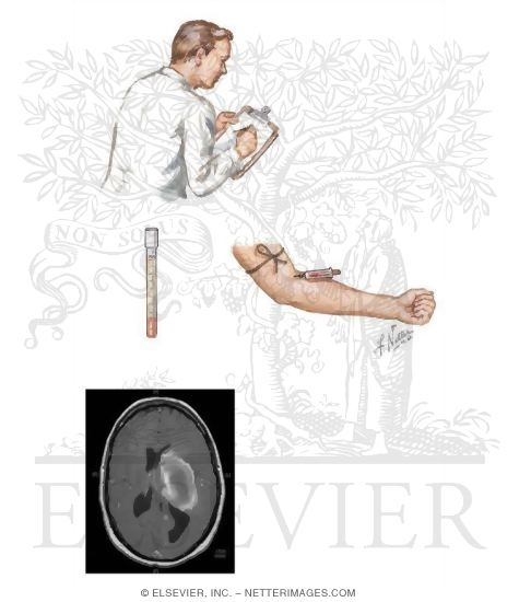 Initial Headache Evaluation