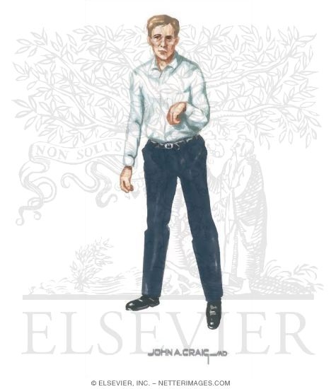 Movement: Rigidity and Stiffness