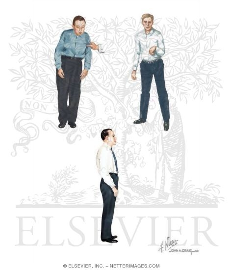 Movement: Rigidity and Stiffness