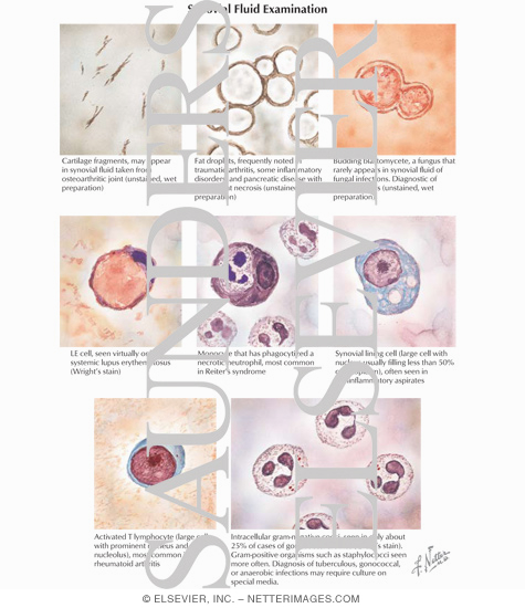 Synovial Fluid Examination
