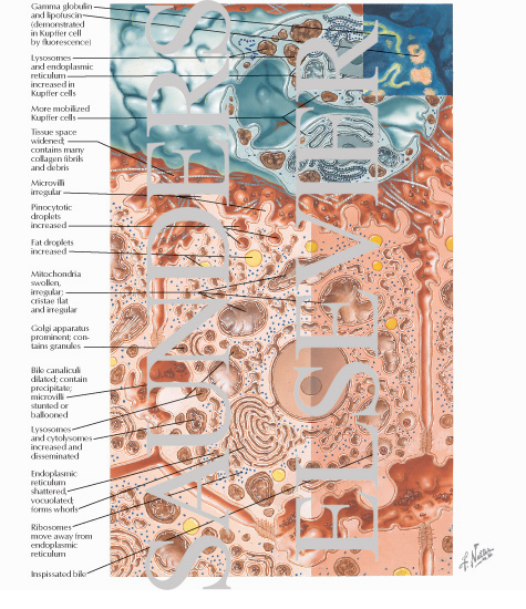 Ultramicroscopic Structure of Abnormal Liver Cells