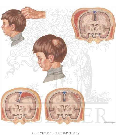 Welcome To Netter Images