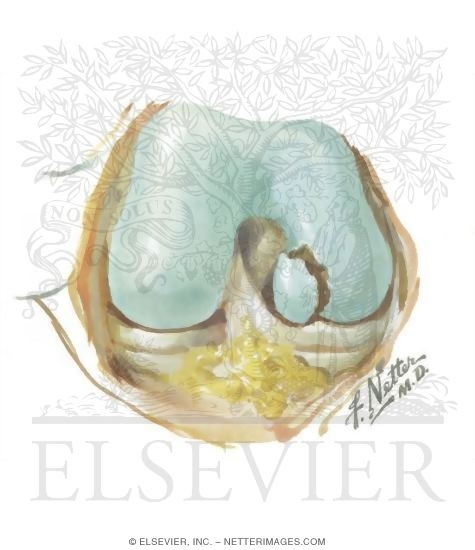 Disorders of the Knee