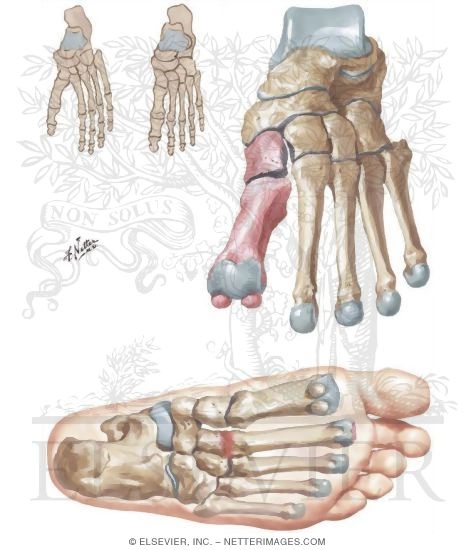 Comparison of Anthropoid and Human Foot - Morton's Foot