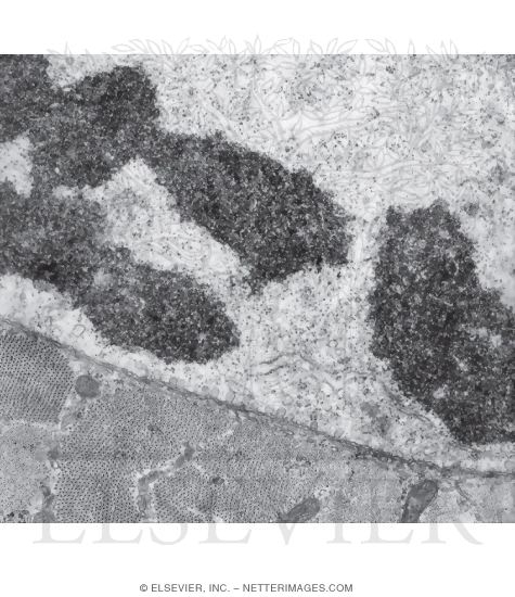 Electron Micrograph of a Satellite Cell In Skeletal Muscle In the ...