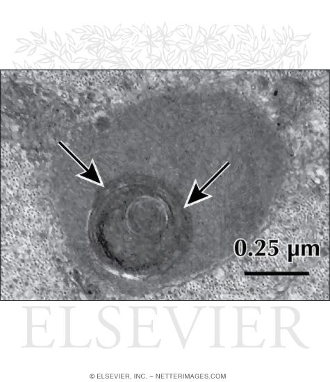 Electron Micrograph of a Secondary Lysosome Electron Micrograph of a Secondary Lysosome