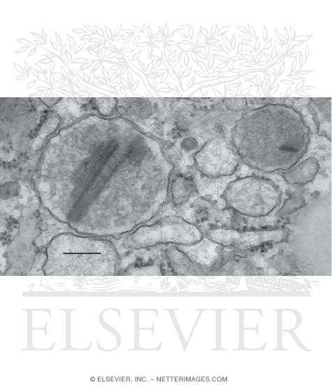 peroxisome electron micrograph