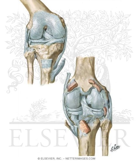 Disorders of the Knee