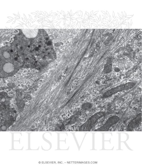 Intermediate Filaments Em