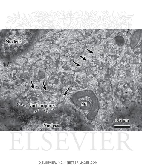 nucleus electron micrograph