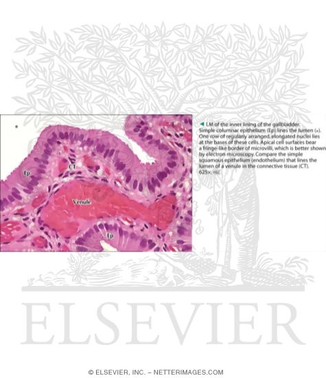 Light Micrograph of the Inner Lining of the Gallbladder