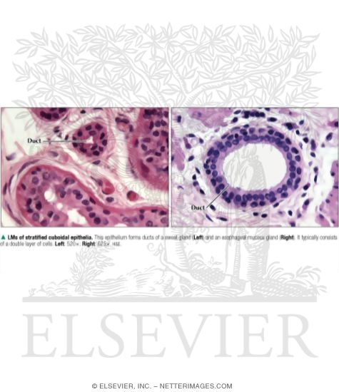 Stratified Cuboidal Labeled