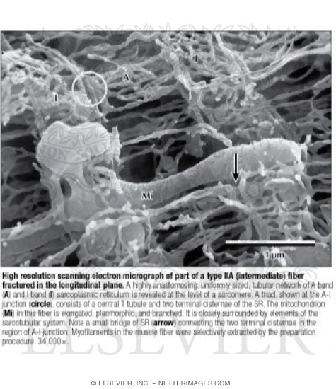 High Resolution Scanning Electron Micrograph of Part of a Type IIA ...