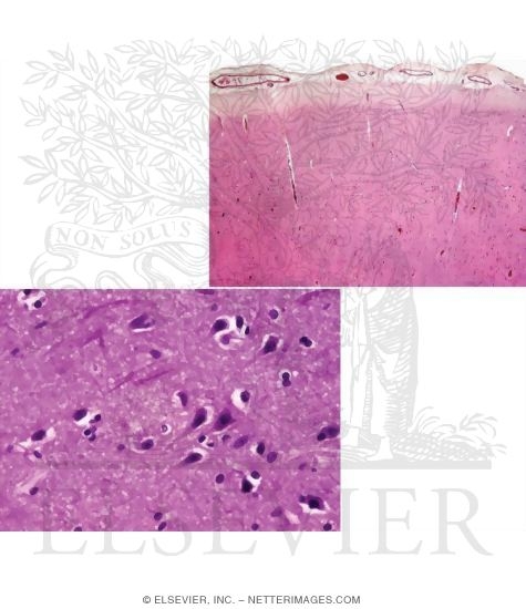 Low-power Light Micrograph of Cerebral Cortex With Higher Magnification ...