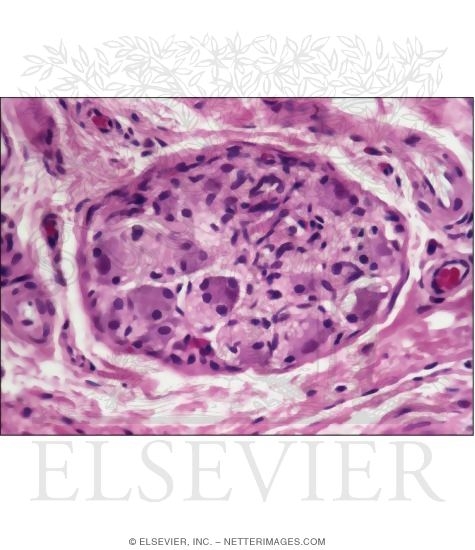 Light Micrograph of an Autonomic Ganglion In the Wall of the Urinary ...