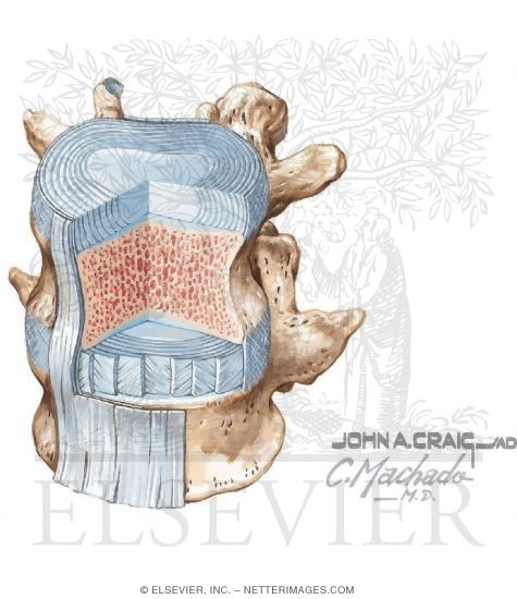 An Intervertebral Disc Connects Bodies of Adjacent Vertebrae With Low ...
