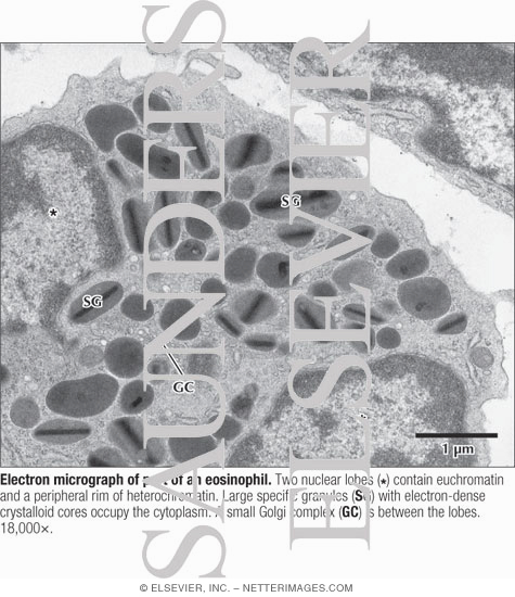 Eosinophil Electron Micrograph