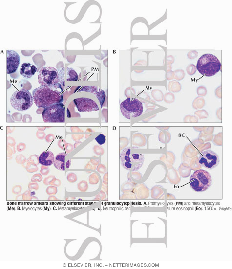 Bone Marrow Smears Showing Different Stages of Granulocytopoiesis