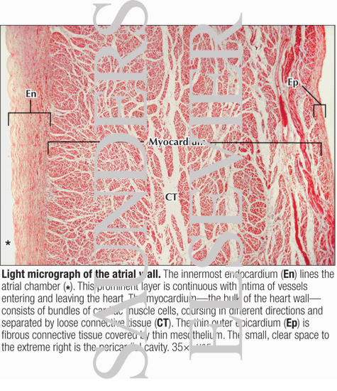 Light Micrograph of the Atrial Wall