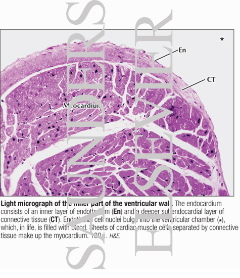 Light Micrograph of the Inner Part of the Ventricular Wall
