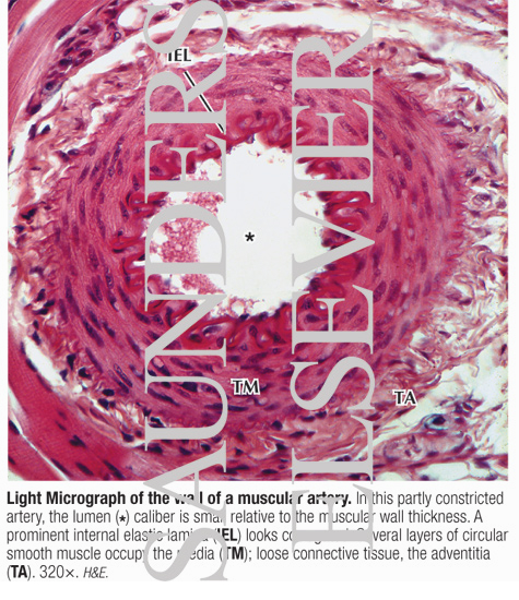 Light Micrograph of the Wall of a Muscular Artery