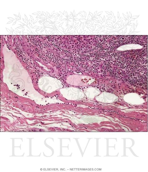 Light Micrograph of a Lymphatic Capillary In Longitudinal Section
