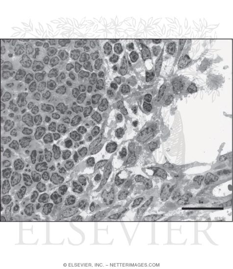 Low-magnification Electron Micrograph of Part of a Lymphoid Nodule In ...