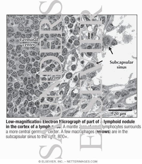 Low-magnification Electron Micrograph of Part of a Lymphoid Nodule In ...