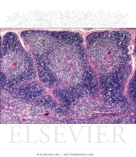 Light Micrograph of Part of a Child’s Thymus