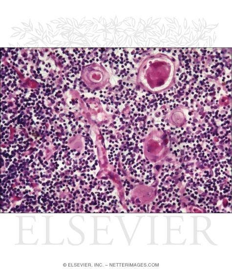 Light Micrograph of Part of the Medulla of a Child's Thymus