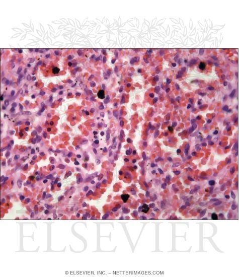 Higher Power Light Micrograph of Red Pulp